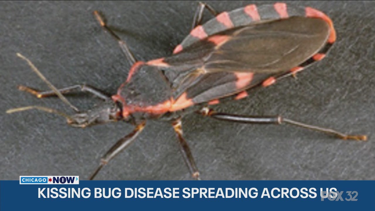Chagas Disease and the ‘Kissing Bug’: What you need to know ...